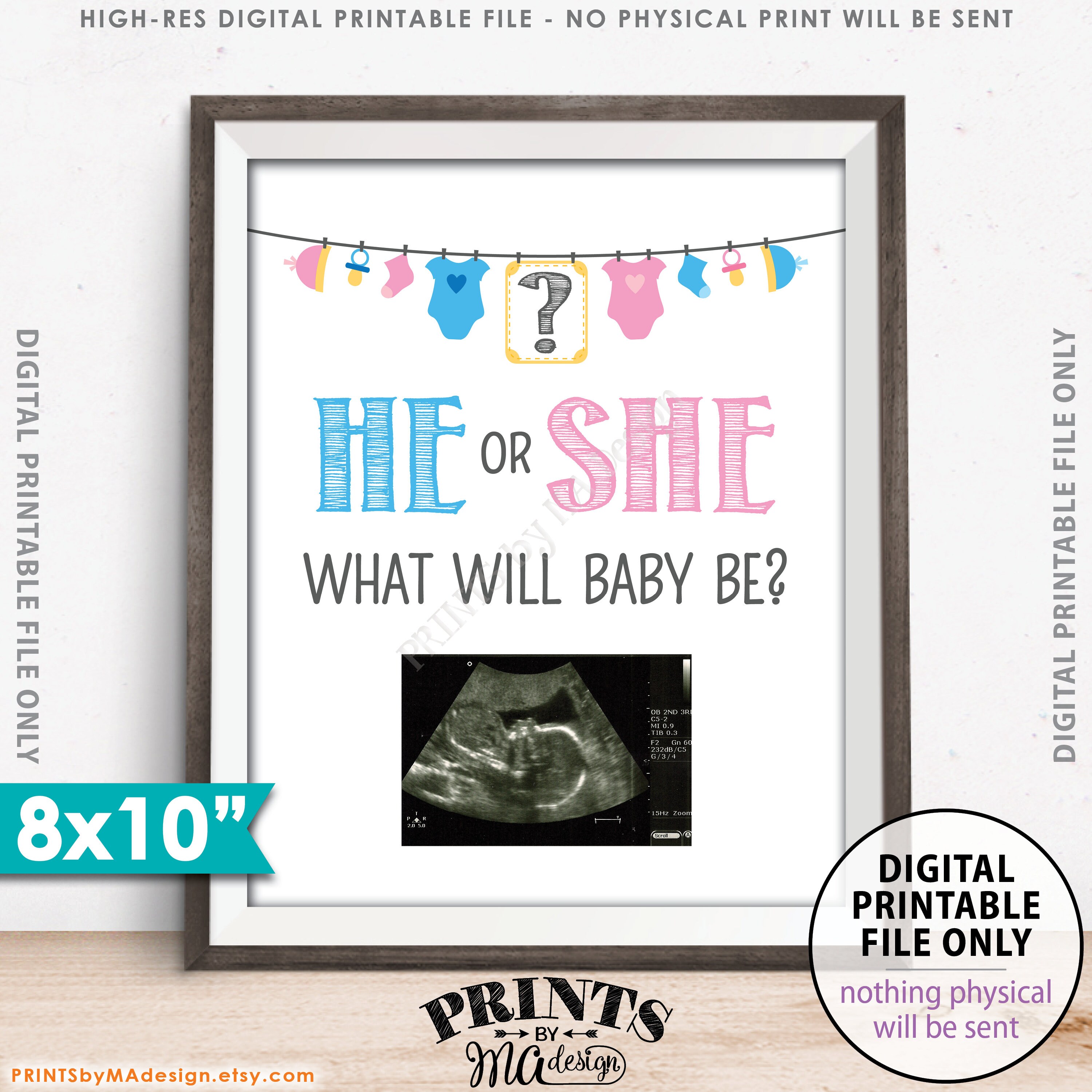 Gender Reveal Sign Ultrasound Photo He or She What Will Baby Be Gender ...