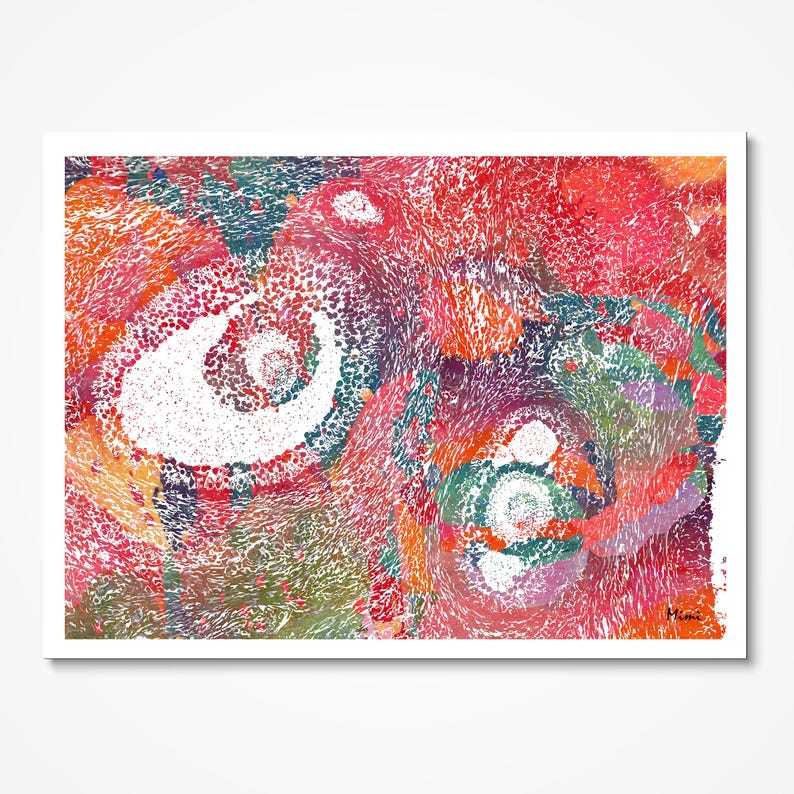 Ovarian Follicles Histology Print | OB-GYN Art | Gynecology Practice ...
