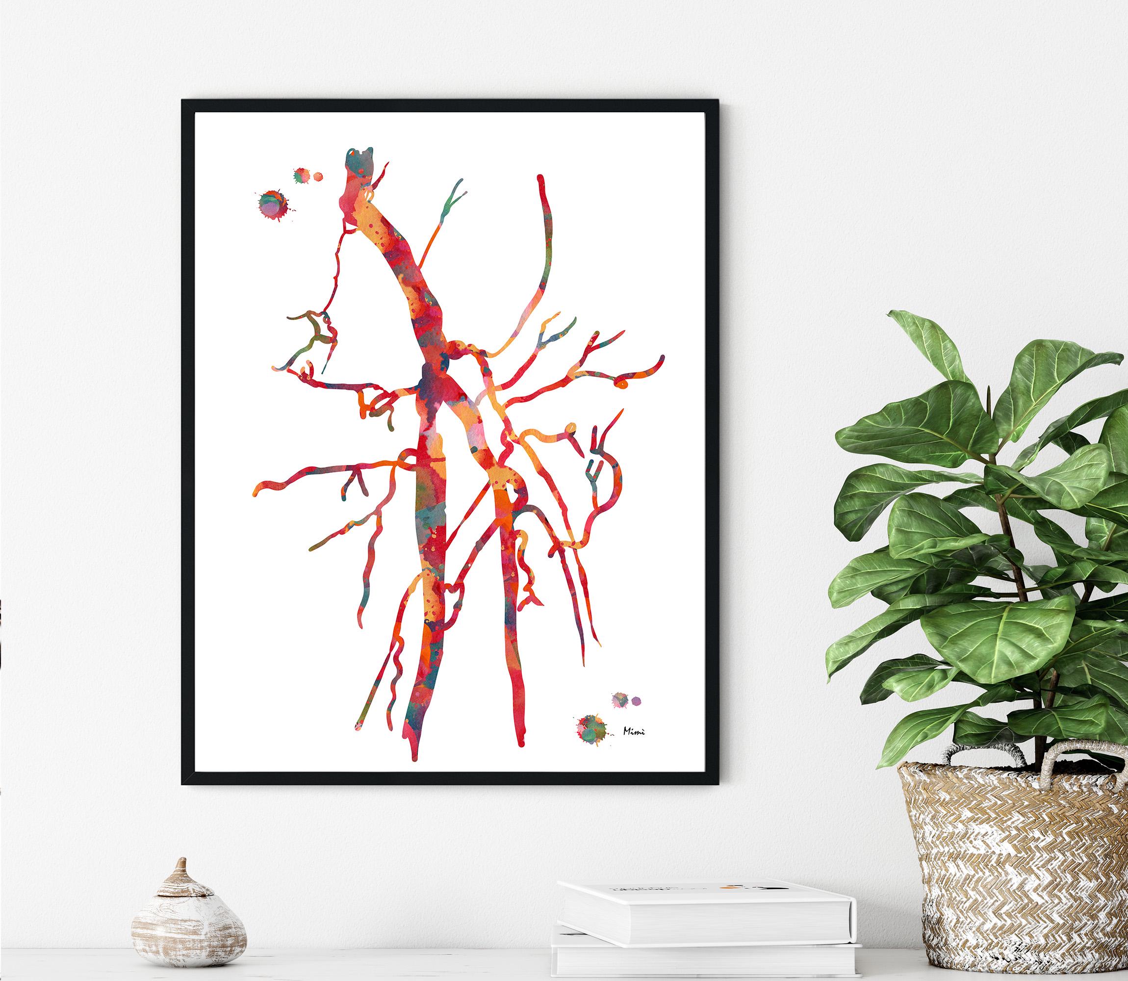 Angiography Print Femoral Spf Artery Occlusion Watercolor Abstract ...