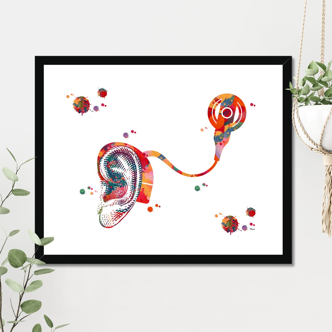 Cochlear Implant Watercolor Print Audiology Poster Inner Ear - Etsy