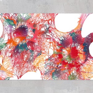 Fibroblast Cells Watercolor Print Fibroblasts Dividing Poster - Etsy