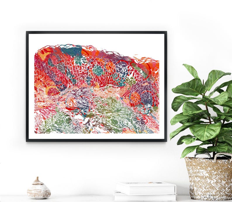 Contact Dermatitis Anatomy Print Dermatology Watercolor Microscopic ...