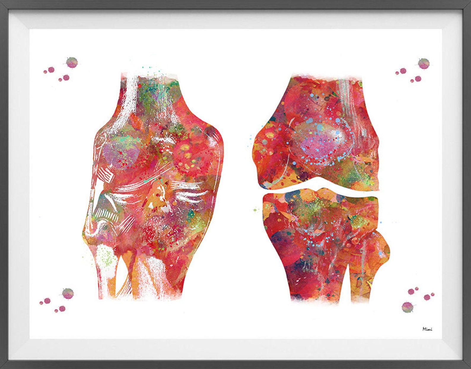 Knee anatomy watercolor print knee joints medical art knee | Etsy