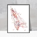 Angiography Print Carotid Artery Watercolor Angiogram Abstract Anatomy ...