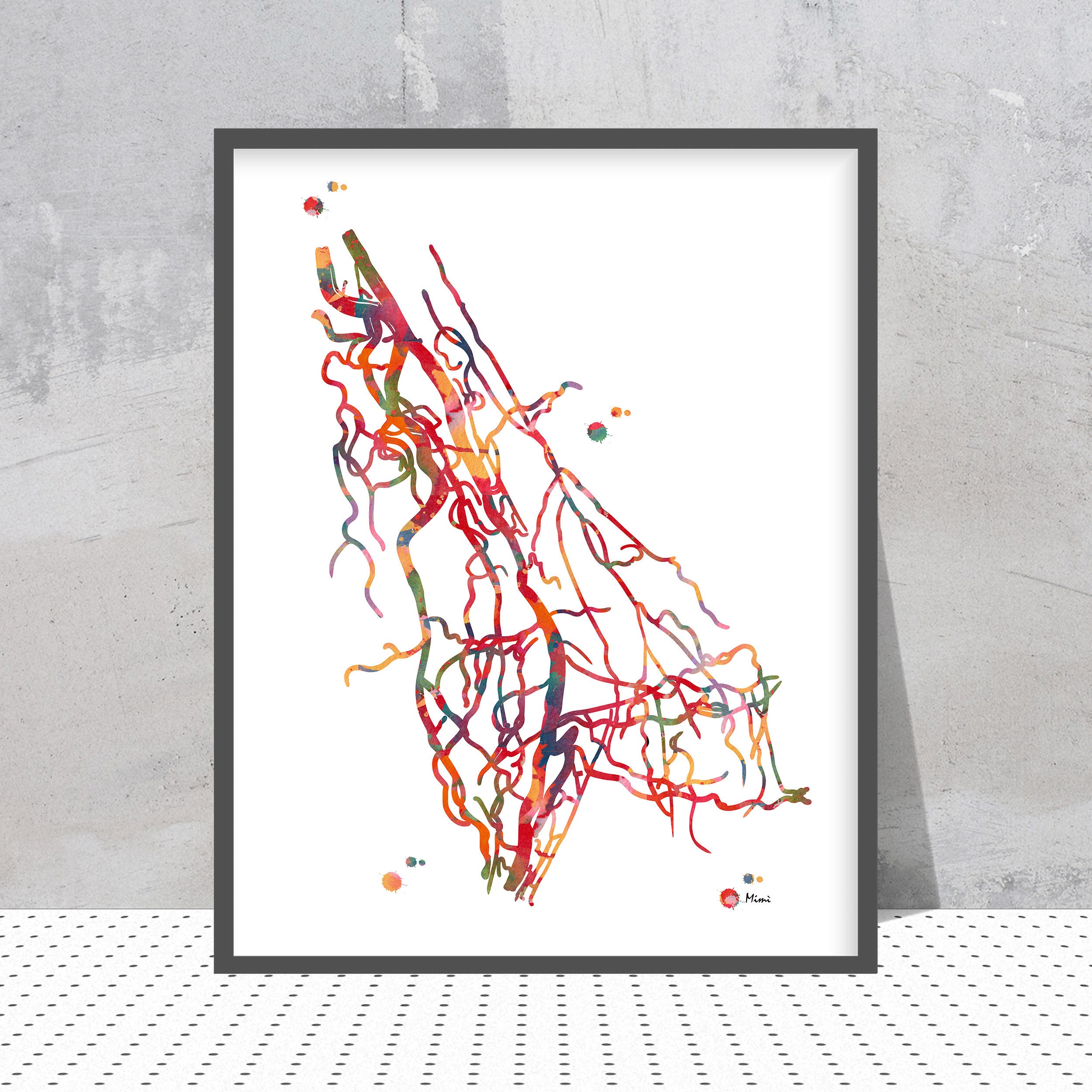 Upper Limb Arteries Angiography Print, Angiogram Watercolor Anatomy Art ...