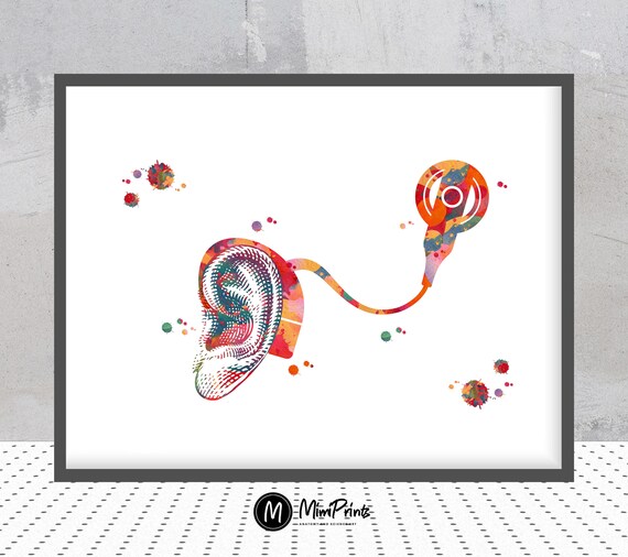 Cochlear Implant Watercolor Print Audiology Poster Inner Ear - Etsy