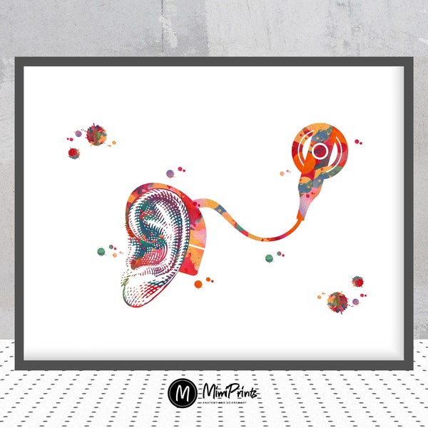 Cochlear Implant - Etsy