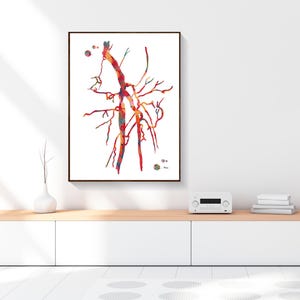 Angiography Print Femoral Spf Artery Occlusion Watercolor Abstract ...