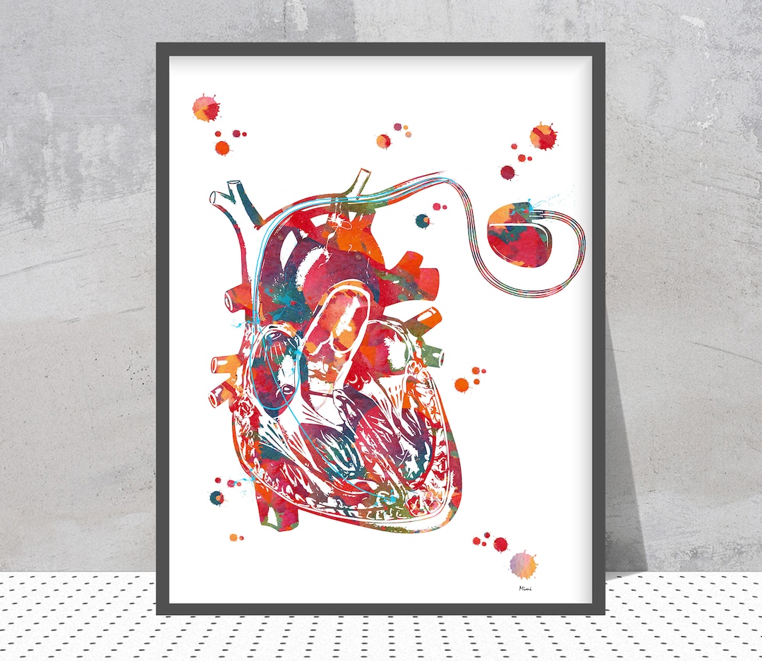 Heart Pacemaker Watercolor Print Anatomy Art Cardiac External Pacemaker ...