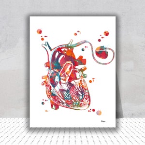 Heart Pacemaker Watercolor Print Anatomy Art Cardiac External Pacemaker ...