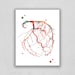 Heart Vascularization Print Coronary Angiogram Poster Cardiology Art ...