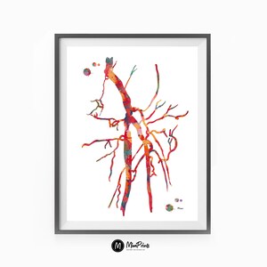 Angiography Print Femoral Spf Artery Occlusion Watercolor Abstract ...