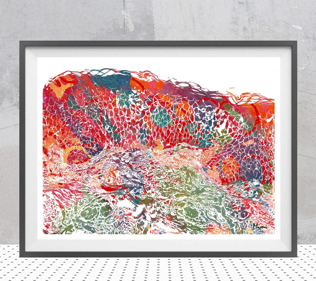 Contact Dermatitis Anatomy Print Dermatology Watercolor Microscopic ...
