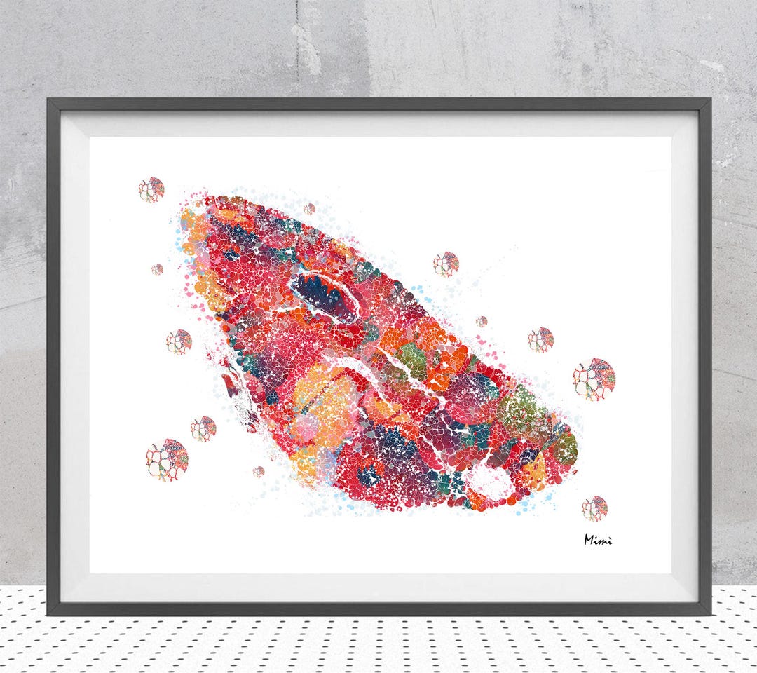 Thyroid and Parathyroid Print Histology Watercolor of the Thyroid Gland ...