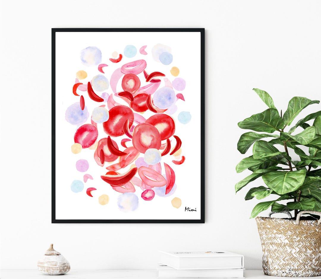 Sickle Cell (SCD) Print - Anemia Watercolor- Hematology Illustration - Etsy