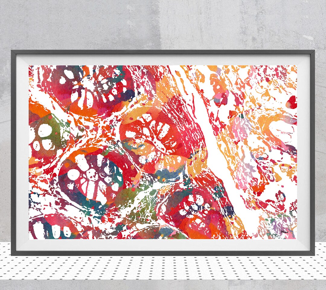 Colon Watercolor Print Abstract Medical Art Human Tissue Histology ...
