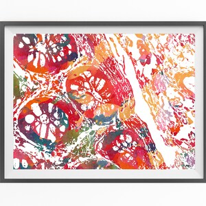 Colon Watercolor Print Abstract Medical Art Human Tissue Histology ...
