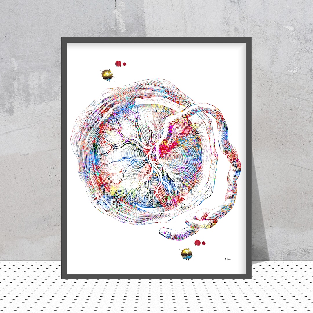 Placenta Print Gynecology Poster Placenta and Umbilical Cord Anatomy ...