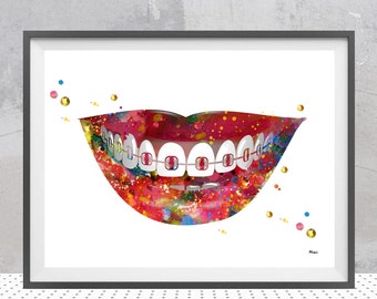 Dental Braces Poster - Etsy