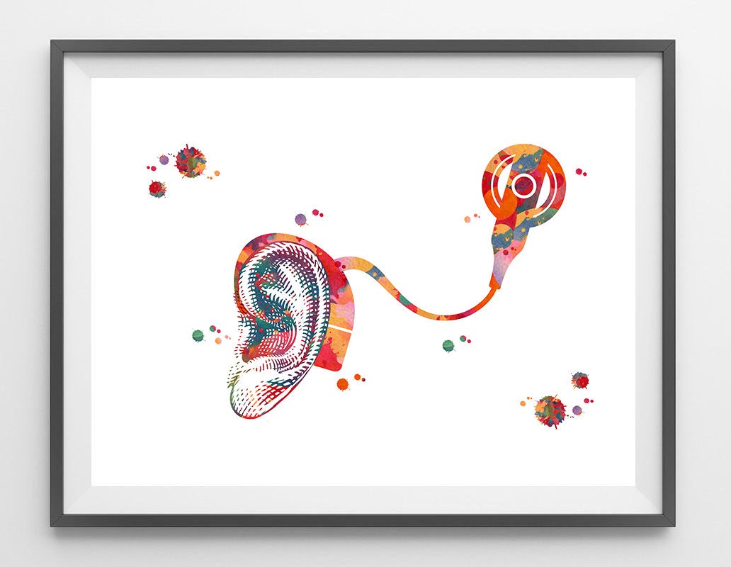 Cochlear Implant Watercolor Print Audiology Poster Inner Ear | Etsy