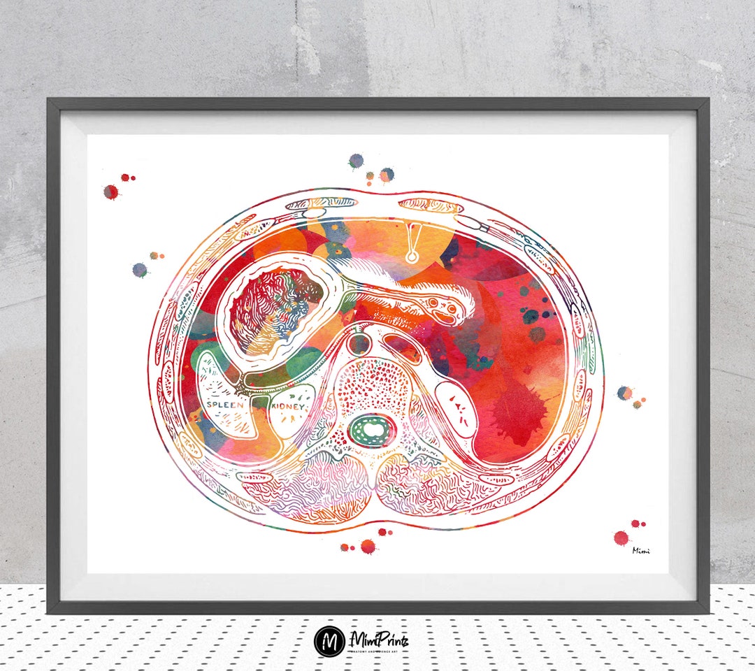 Abdomen Cross Section Anatomy Print GI Human Abdomen Medical Art Poster ...