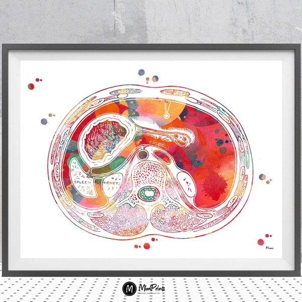 General Surgery Watercolor Art - Etsy