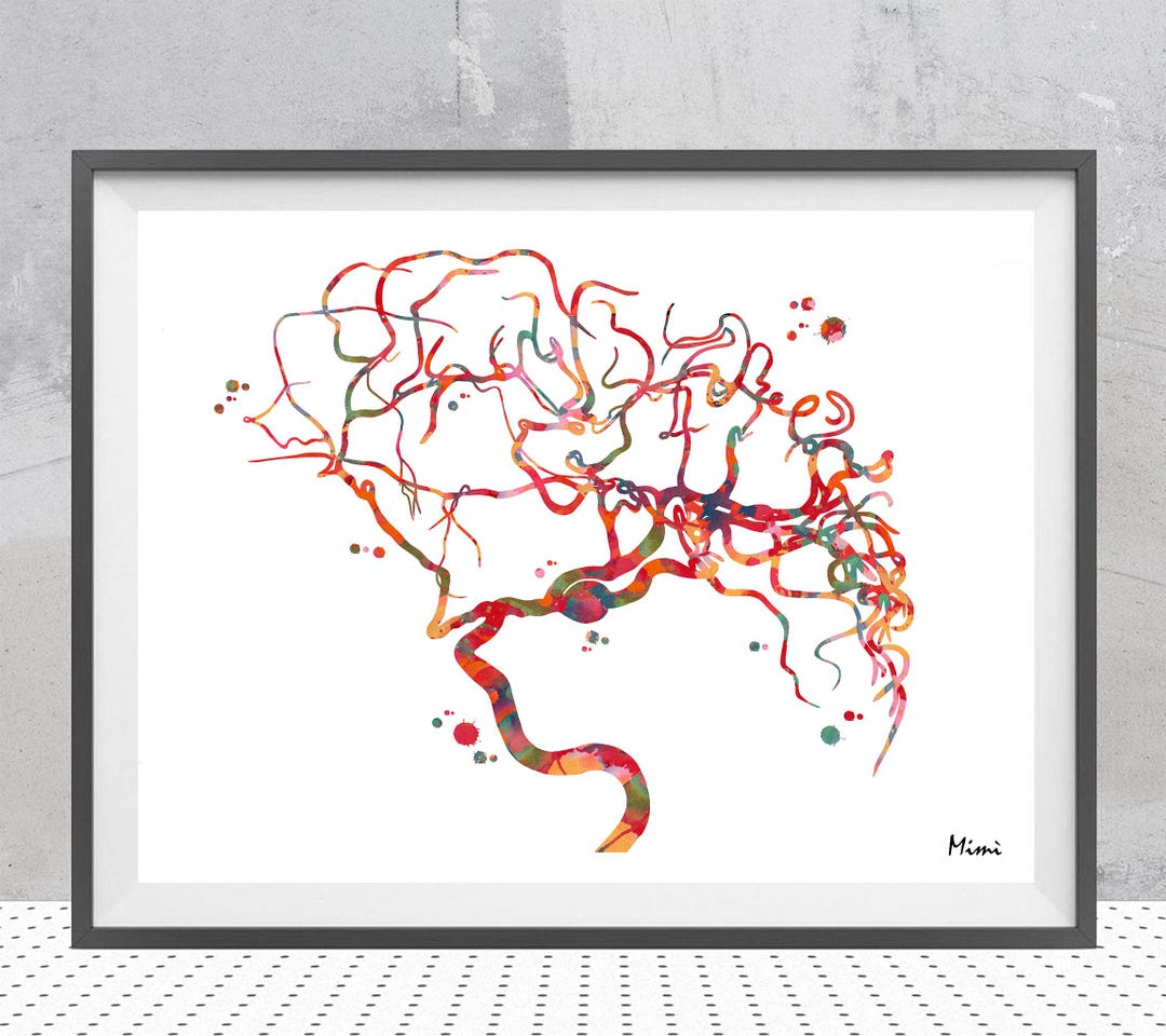 Cerebral Aneurysm Print Brain Angiography Watercolor Anatomy Art ...