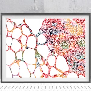 Thyroid Gland Tissue Print Histology Watercolor of the Human Thyroid ...