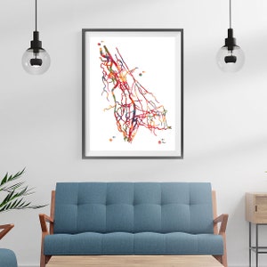 Upper Limb Arteries Angiography Print, Angiogram Watercolor Anatomy Art ...