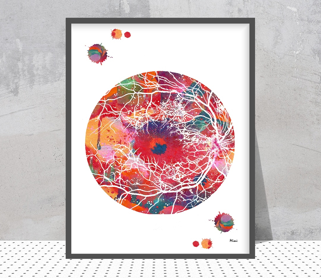 Retina Art Print Eye Anatomy Poster Optometry Illustration Optic Disc ...