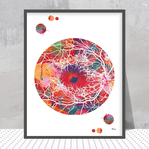 Retina Art Print Eye Anatomy Poster Optometry Illustration - Etsy