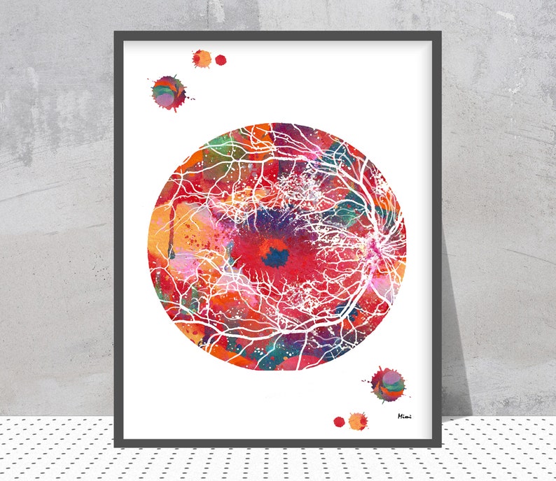 Retina Art Print Eye Anatomy Poster Optometry Illustration - Etsy