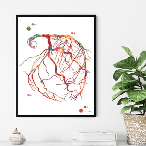 Heart Vascularization Print Coronary Angiogram Poster Cardiology Art ...