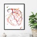 Heart Vascularization Print Coronary Angiogram Poster Cardiology Art ...