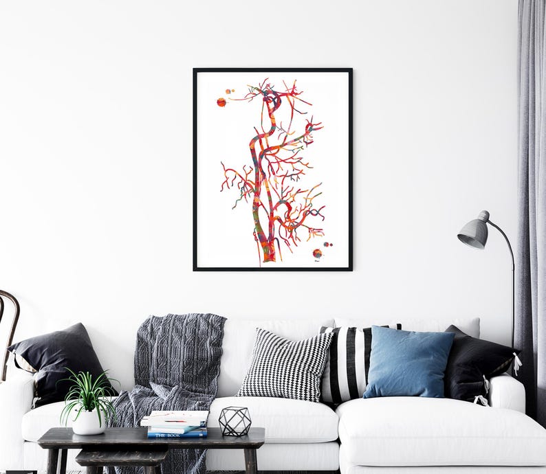 Carotid Artery Angiography Watercolor Print, Neurosurgery Art - Etsy