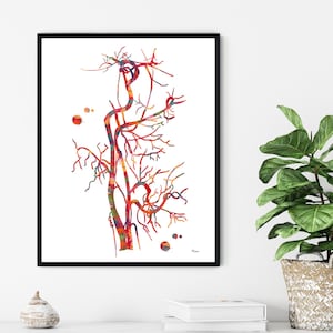 Carotid Artery Angiography Watercolor Print, Neurosurgery Art - Etsy