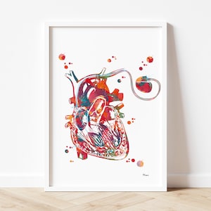 Heart Pacemaker Watercolor Print Anatomy Art Cardiac External Pacemaker ...