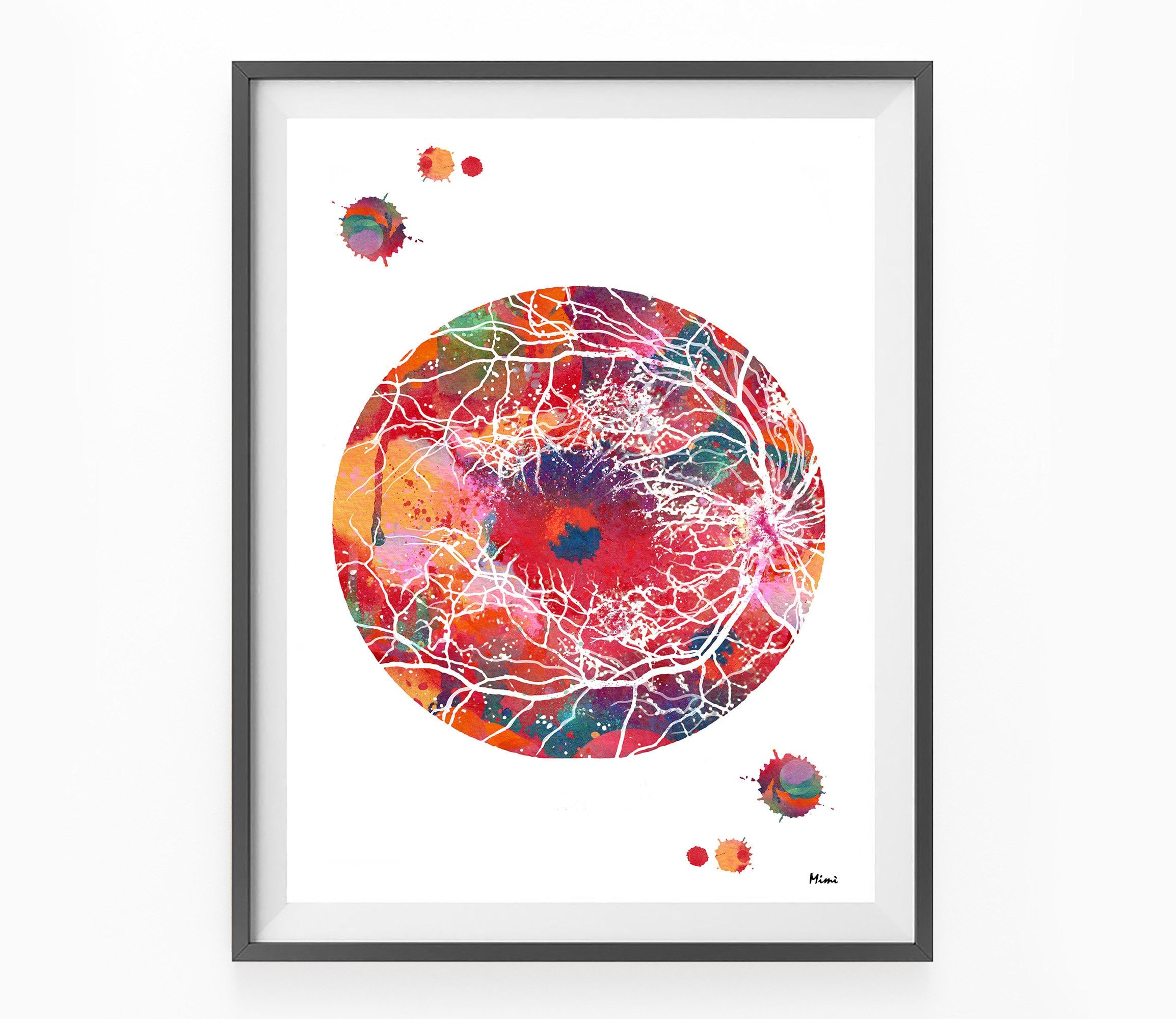 Retina Art Print Eye Anatomy Poster Optometry Illustration | Etsy