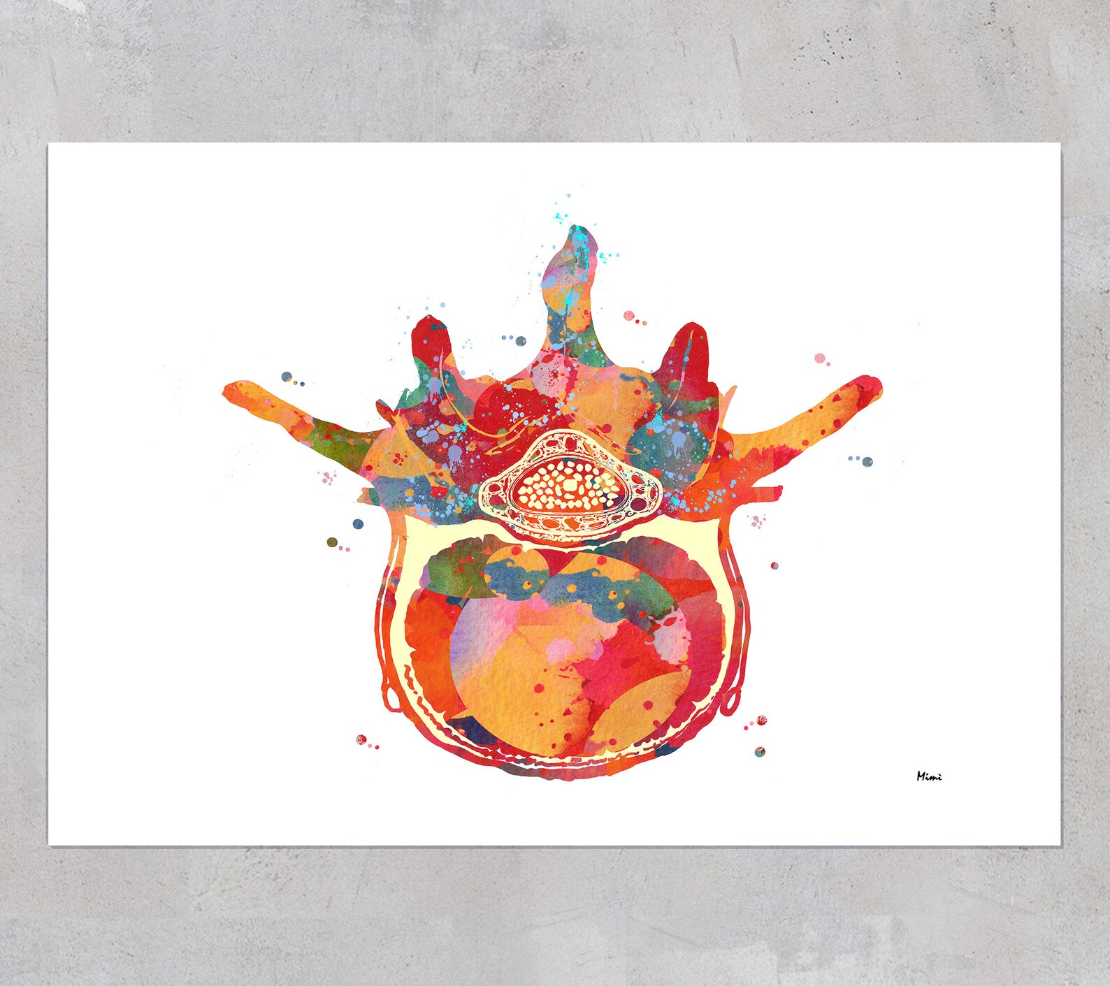 Lumbar Vertebra Print Anatomy Art Poster Vertebra View With - Etsy