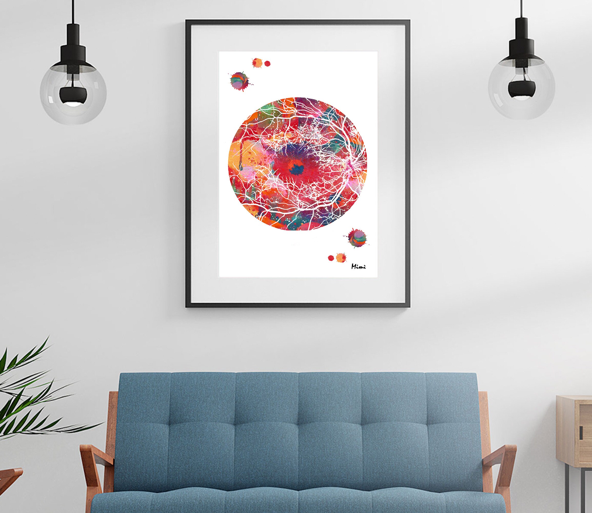 Retina Art Print Eye Anatomy Poster Optometry Illustration - Etsy