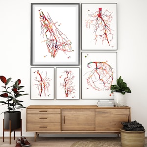 Upper Limb Arteries Angiography Print, Angiogram Watercolor Anatomy Art ...