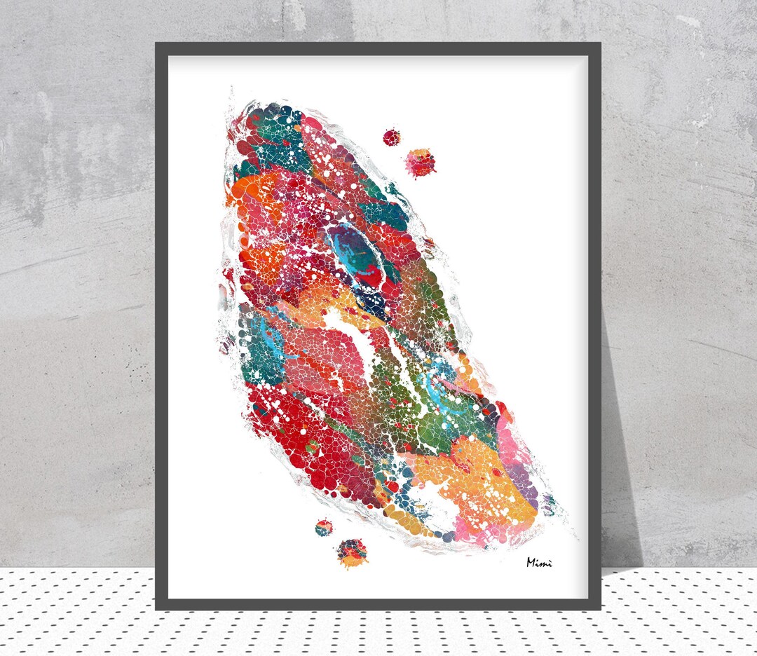 Parathyroid Gland Print Anatomy Art the Human Thyroid and Parathyroid ...