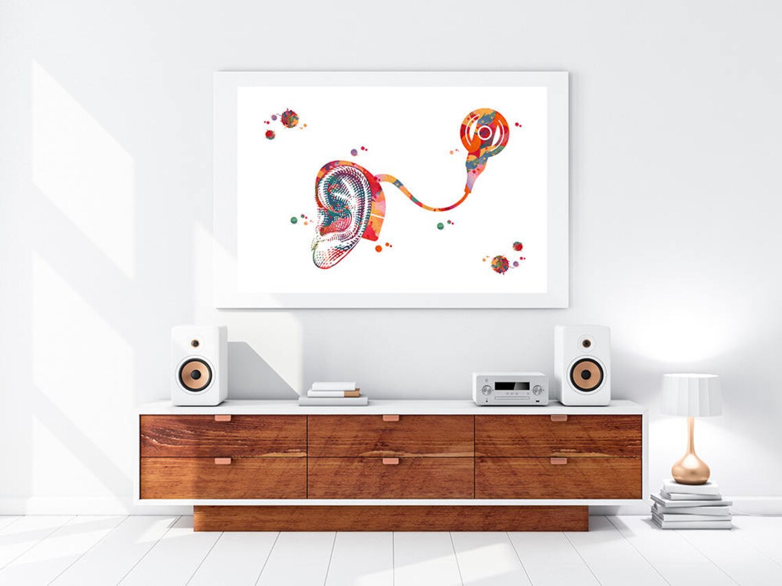 Cochlear Implant Watercolor Print Audiology Poster Inner Ear | Etsy