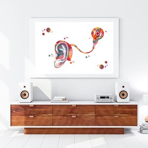 Cochlear Implant Watercolor Print Audiology Poster Inner Ear Hearing ...