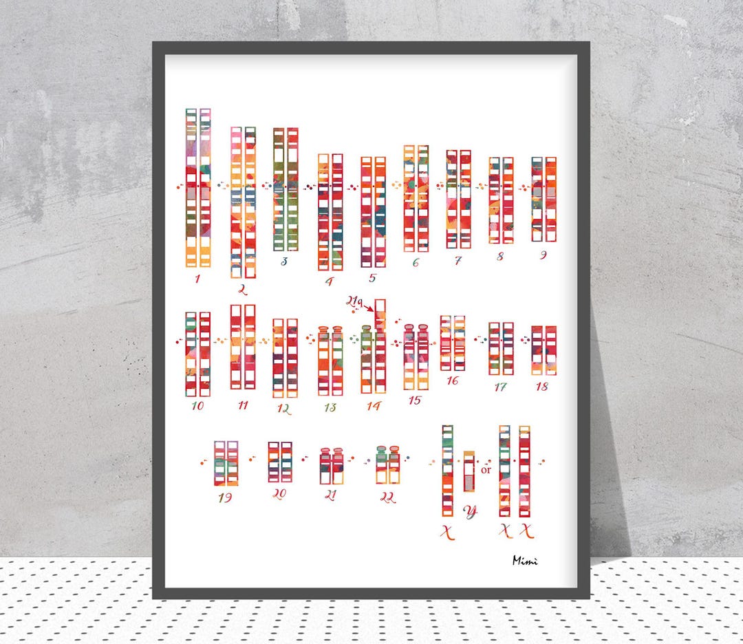 Down Syndrome Translocation Print Down Syndrome Chromosome Idiogram ...