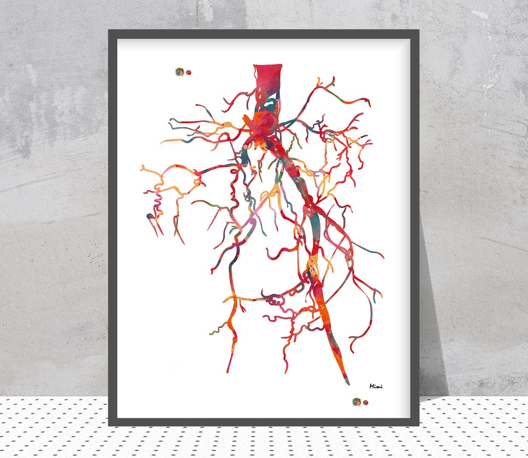 Aorta Print Angiogram of the Aorta Angiography Watercolor Angiology ...