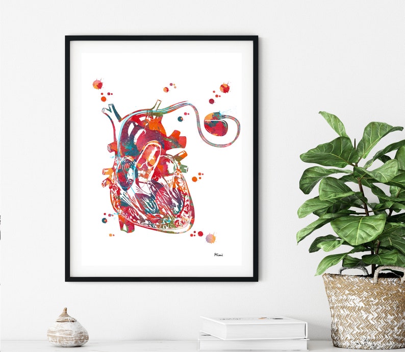 Heart Pacemaker Watercolor Print Anatomy Art Cardiac External - Etsy