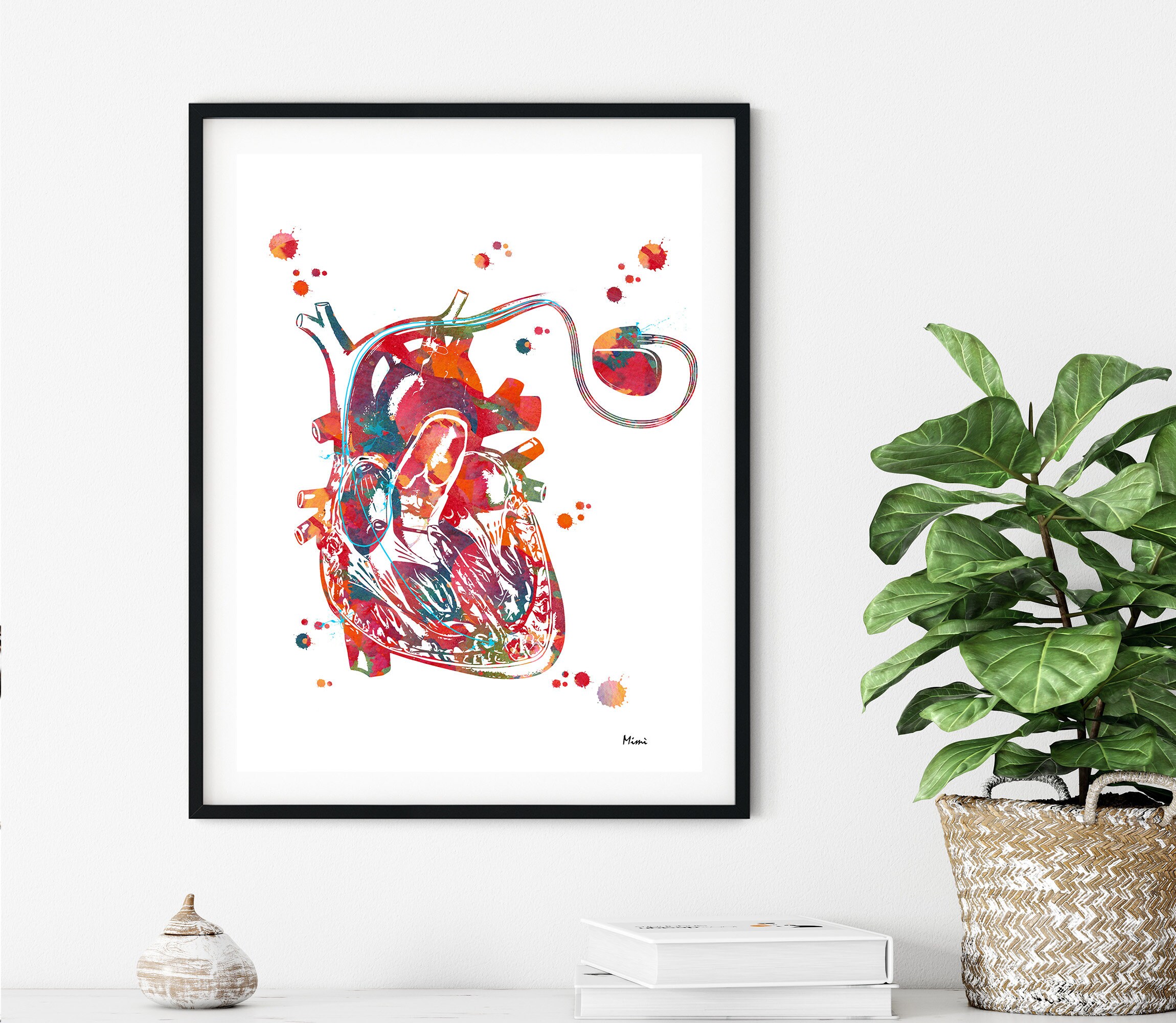 Heart Pacemaker Watercolor Print Anatomy Art Cardiac External - Etsy UK