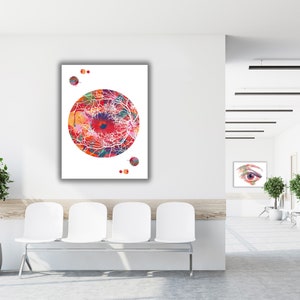 Retina Art Print Eye Anatomy Poster Optometry Illustration Optic Disc ...