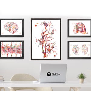 Angiography Print Carotid Artery Watercolor Angiogram Abstract Anatomy ...
